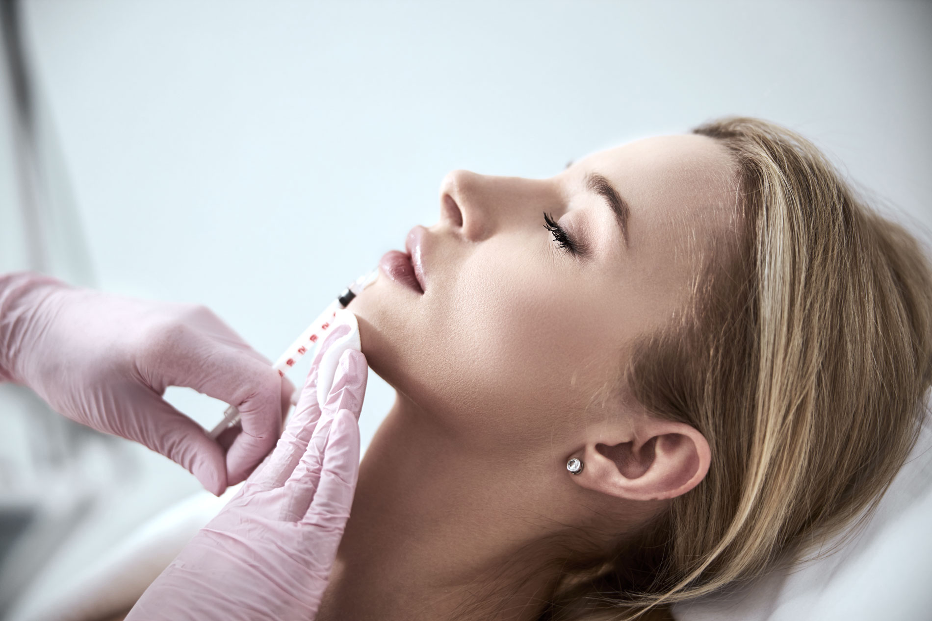 Dermal Fillers in North London | Facial Fillers - The Axis Clinic