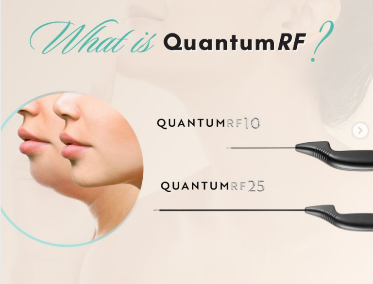 Quantum RF - Axis Clinic